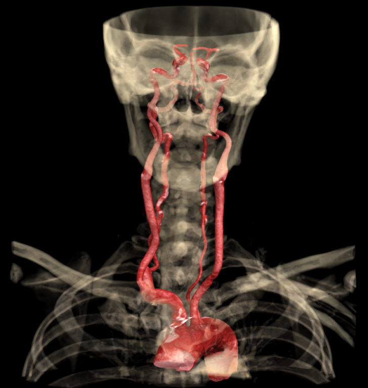 Neuro - Canon Medical Informatics