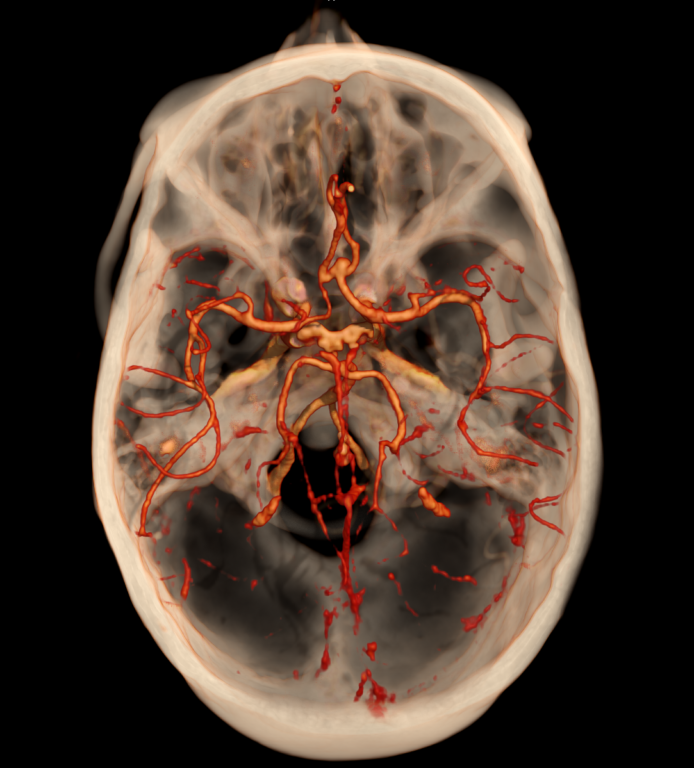 Neuro - Canon Medical Informatics