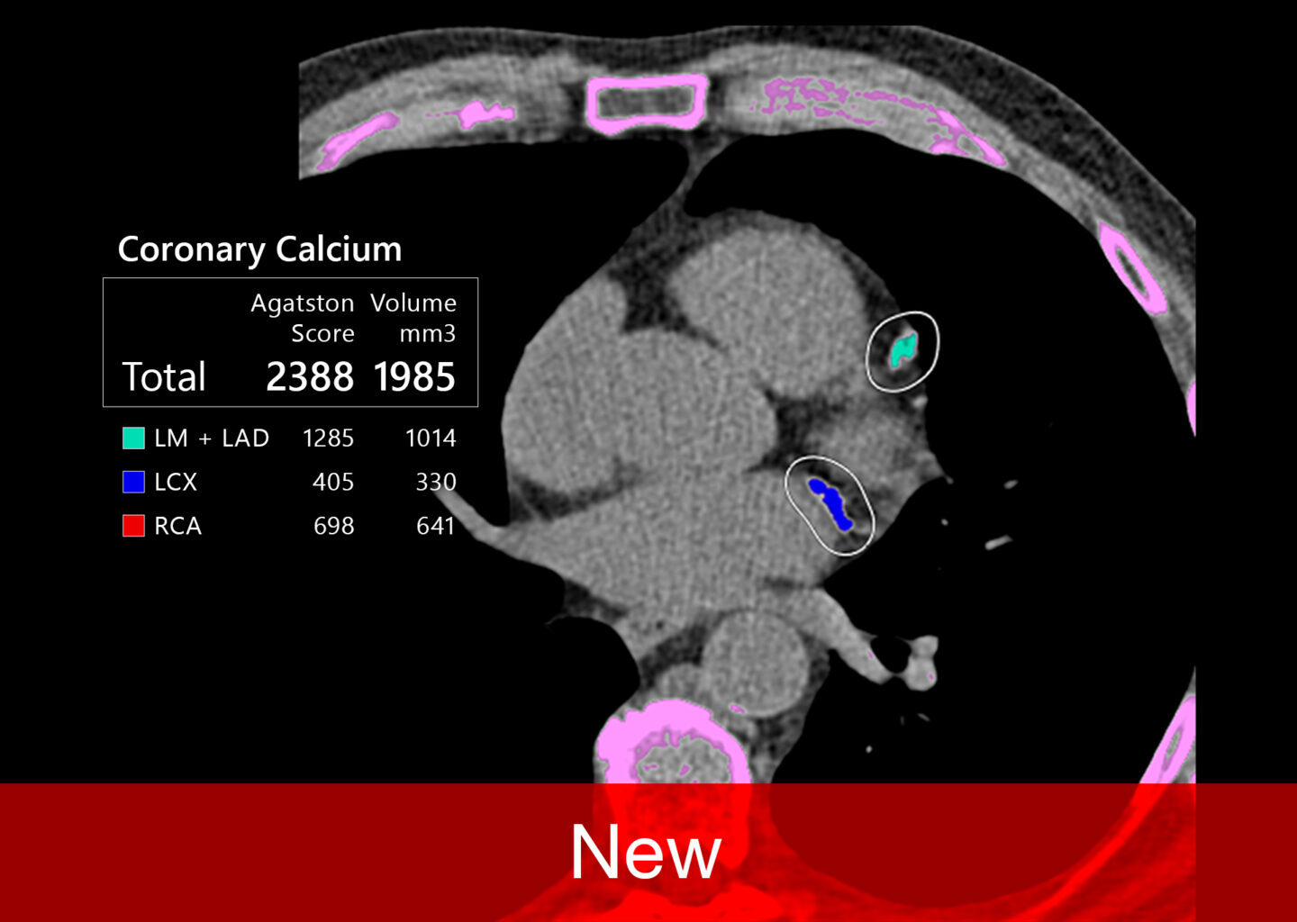 Cardiac Imaging - Canon Medical Informatics