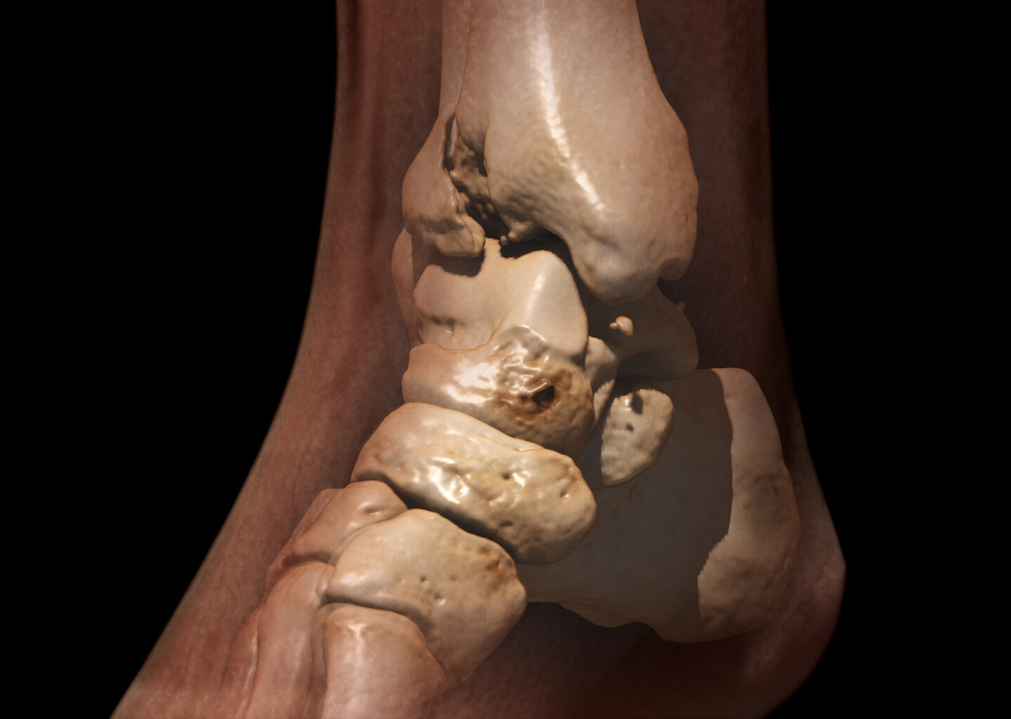 Musculoskeletal - Canon Medical Informatics