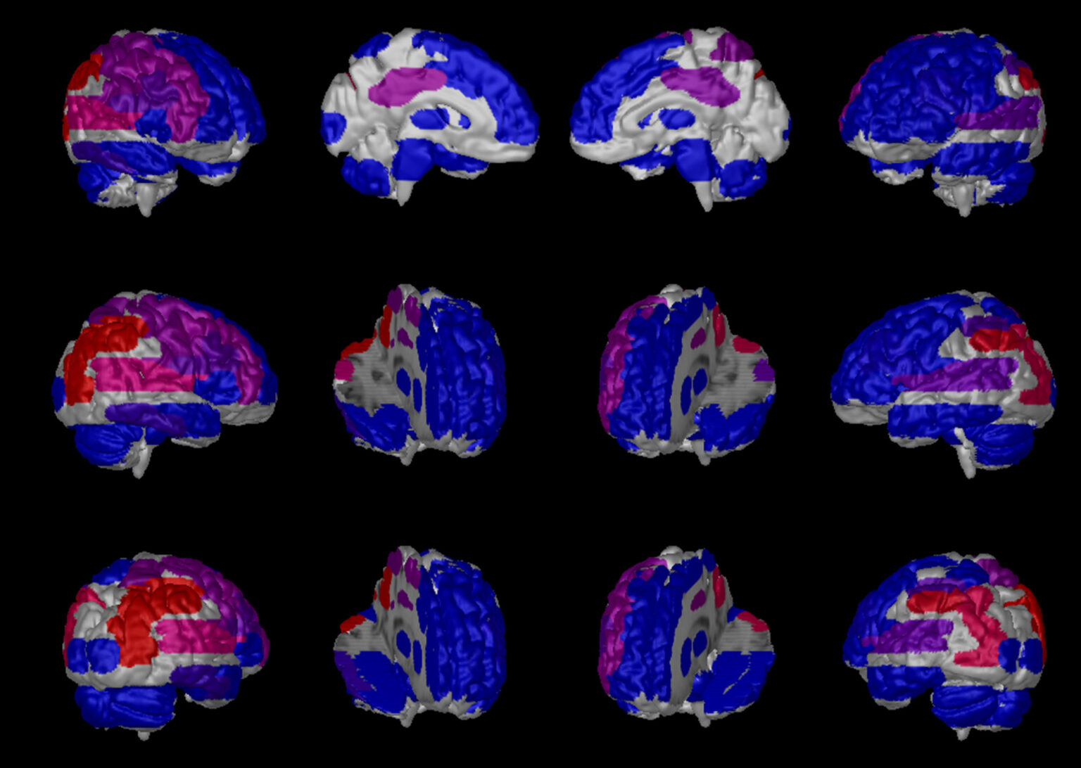 Neuro - Canon Medical Informatics