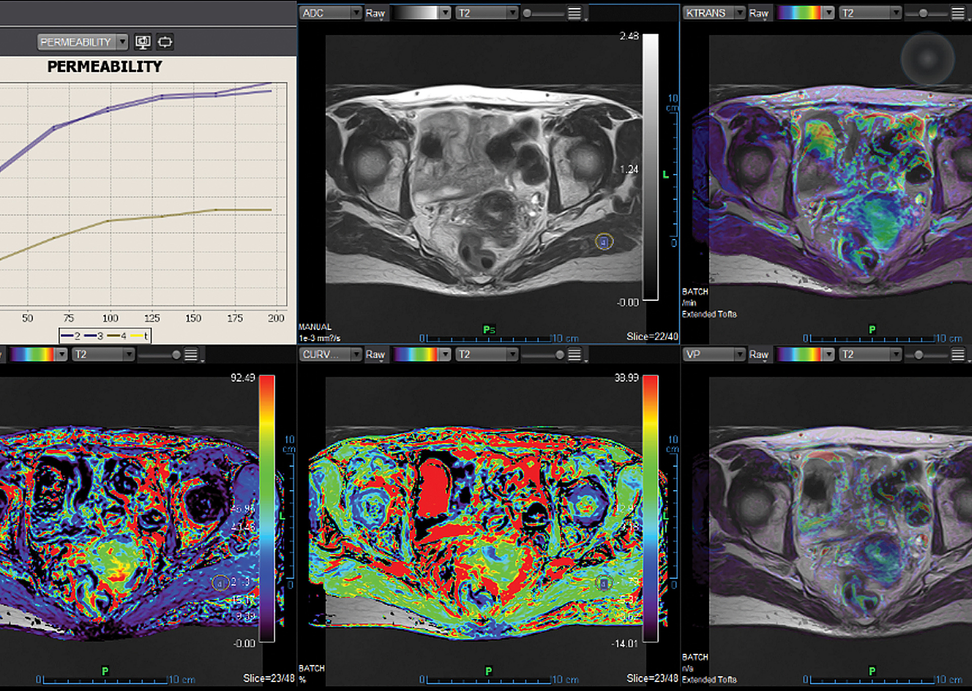 Oncology - Canon Medical Informatics