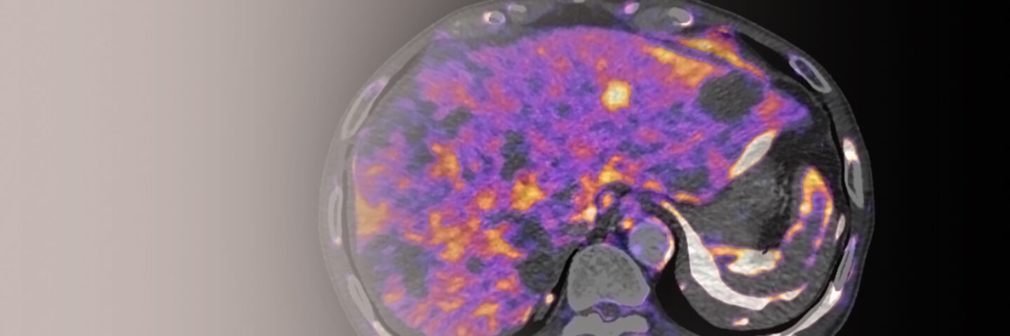 Oncology - Canon Medical Informatics