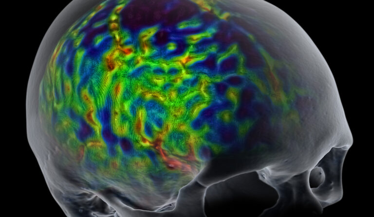 Vitrea Advanced Visualization - Canon Medical Informatics