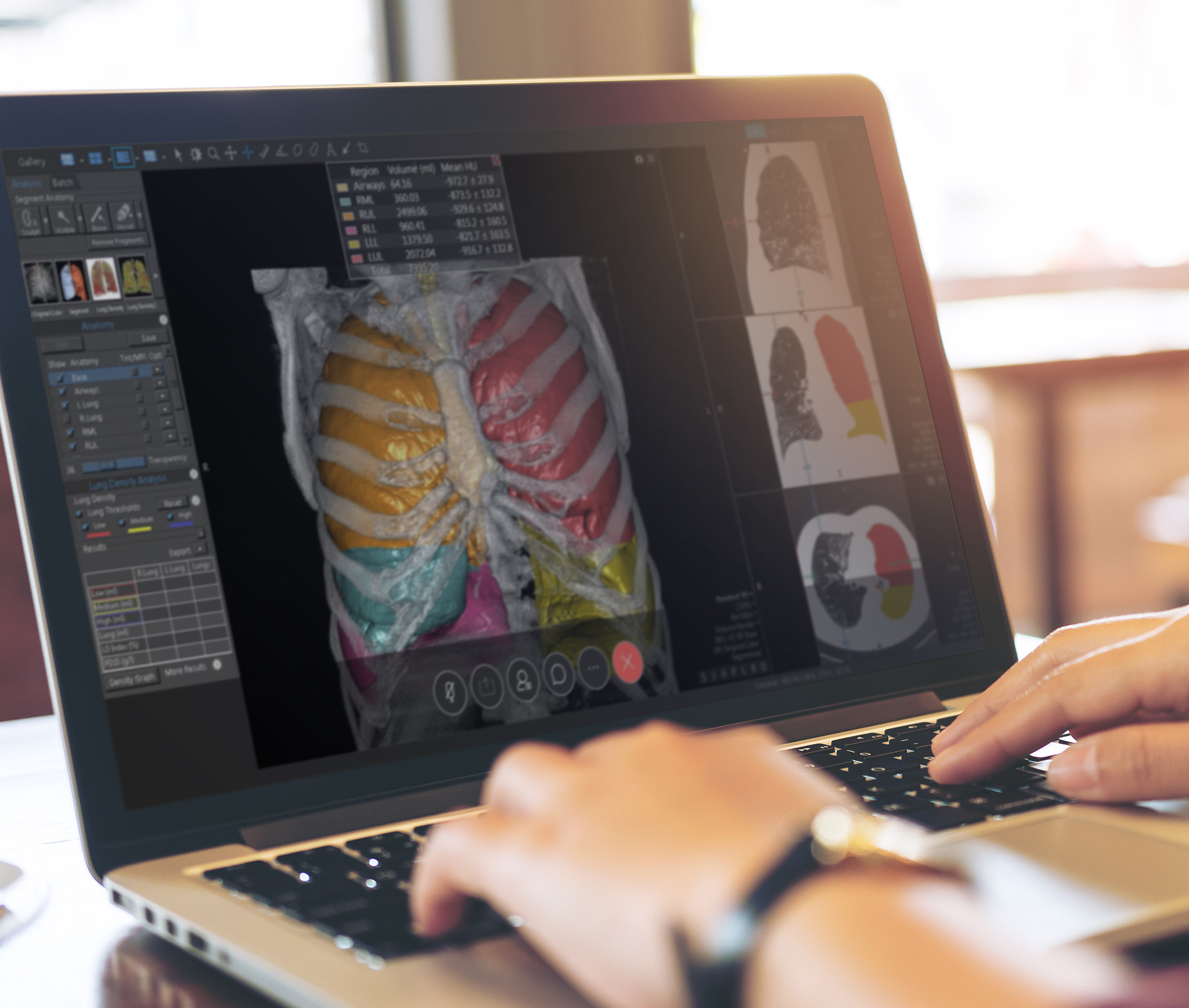 Support and Services - Canon Medical Informatics